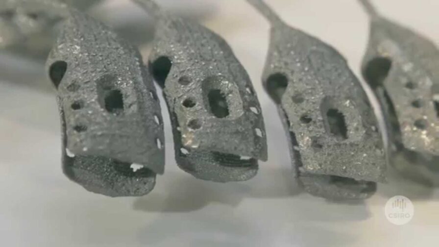 The World's First 3D-Printed Titanium Rib Cage Is a Medical Marvel