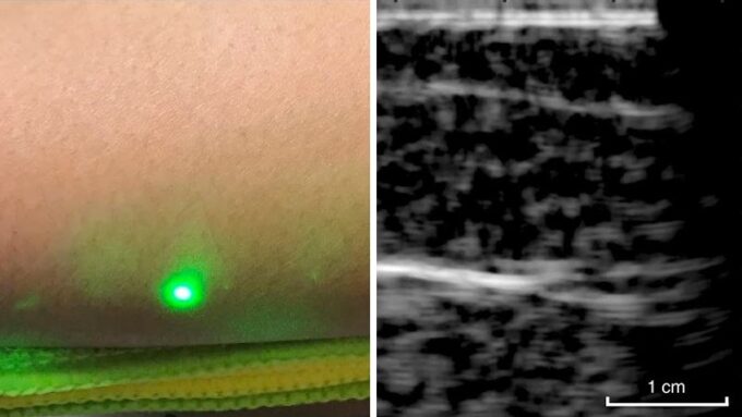 MIT Engineers Create Laser Ultrasounds That Can Look Inside Your Body ...