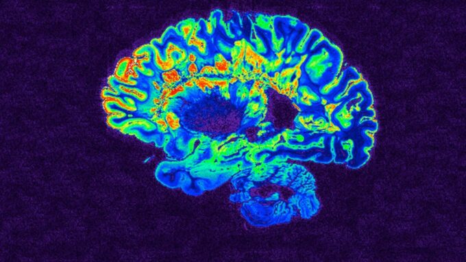 Anesthetized Monkeys Wake Up Instantly When Researchers Stimulate Brain ...
