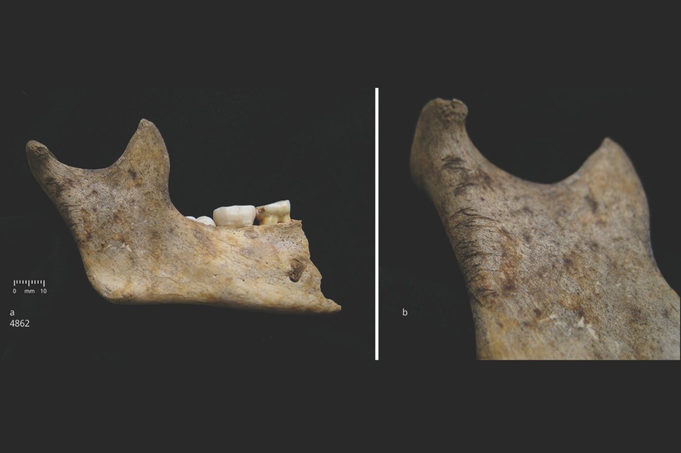 Killed, Butchered and Cannibalized: Archaeologists Uncover Horrific ...