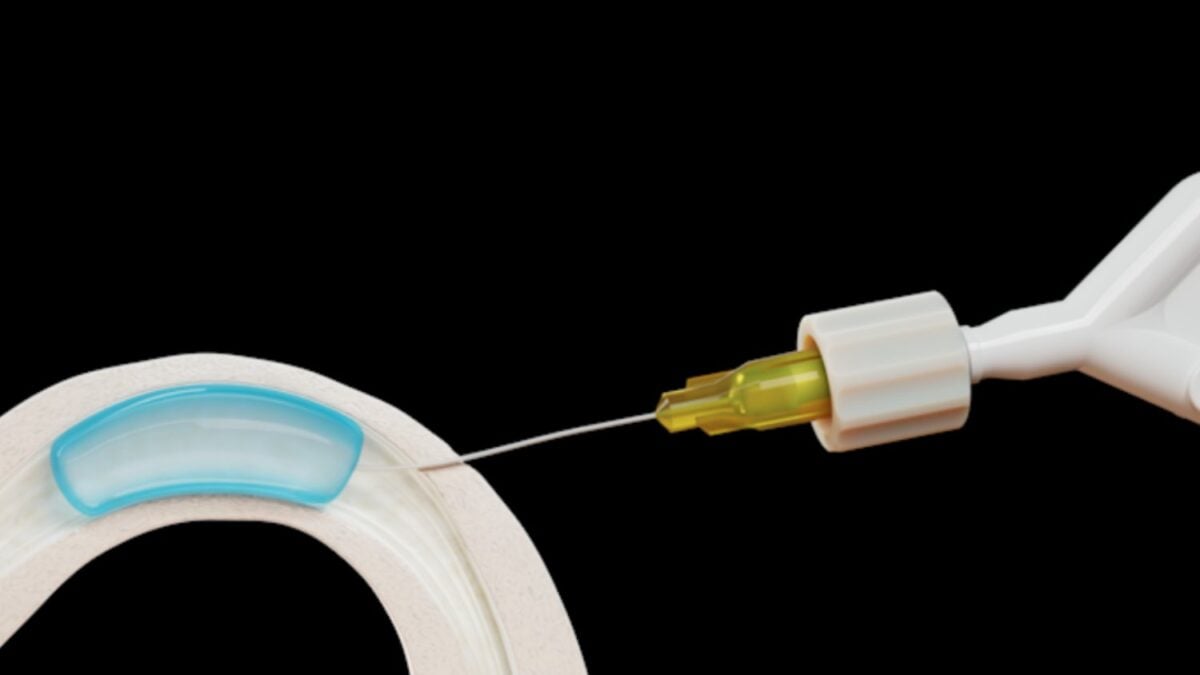 Injectable Birth Control Icd 10