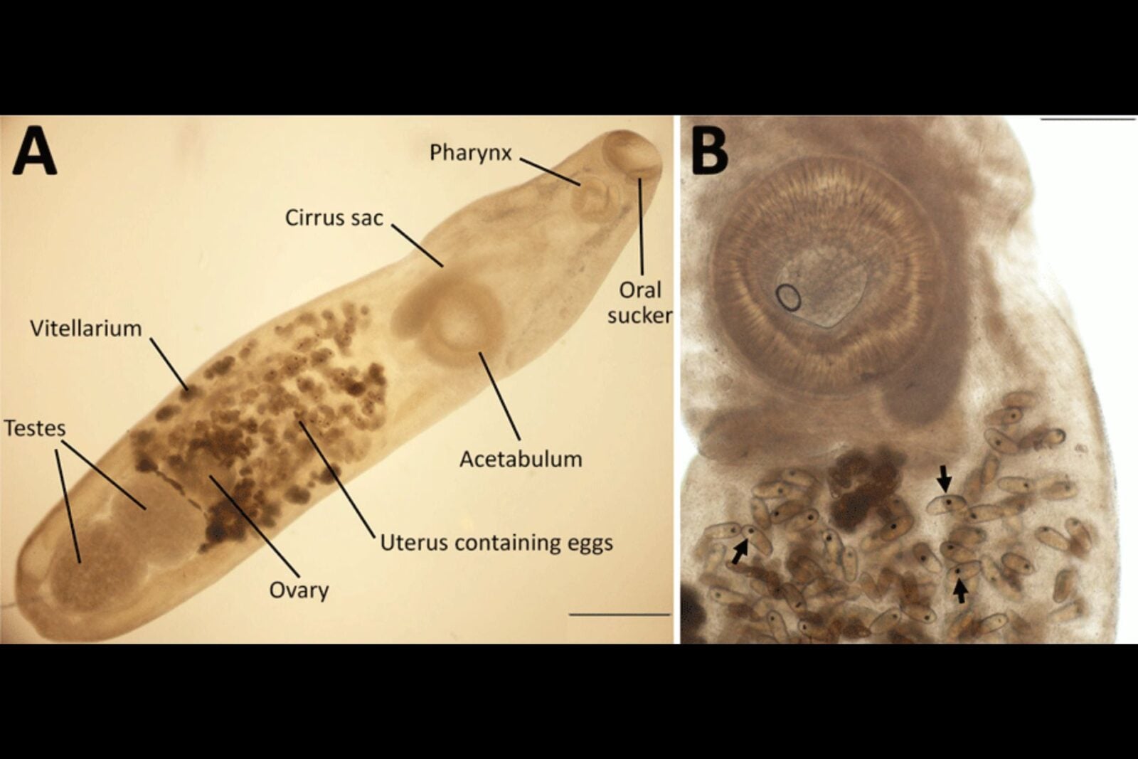 Woman Visits the Galápagos and All She Got Was This Exotic Eye Parasite