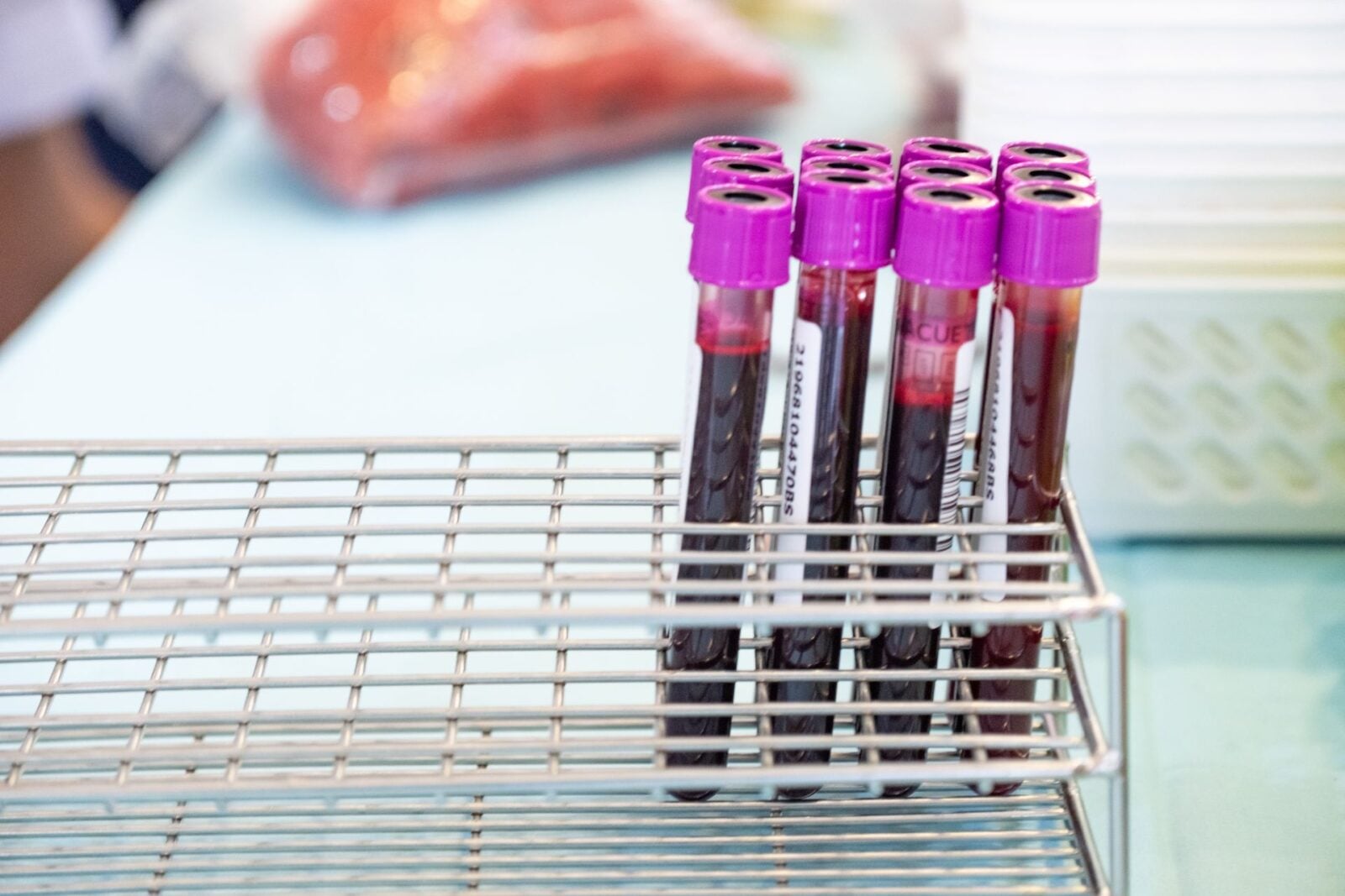 A Simple Blood Test Could Eventually Tell You When Alzheimer’s Is Coming